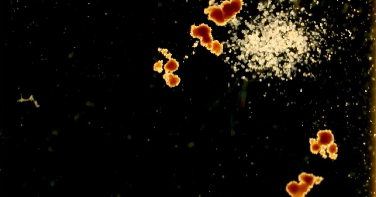 CombiCult® Technology Amplifies Stem Cells in Umbilical Cord Blood