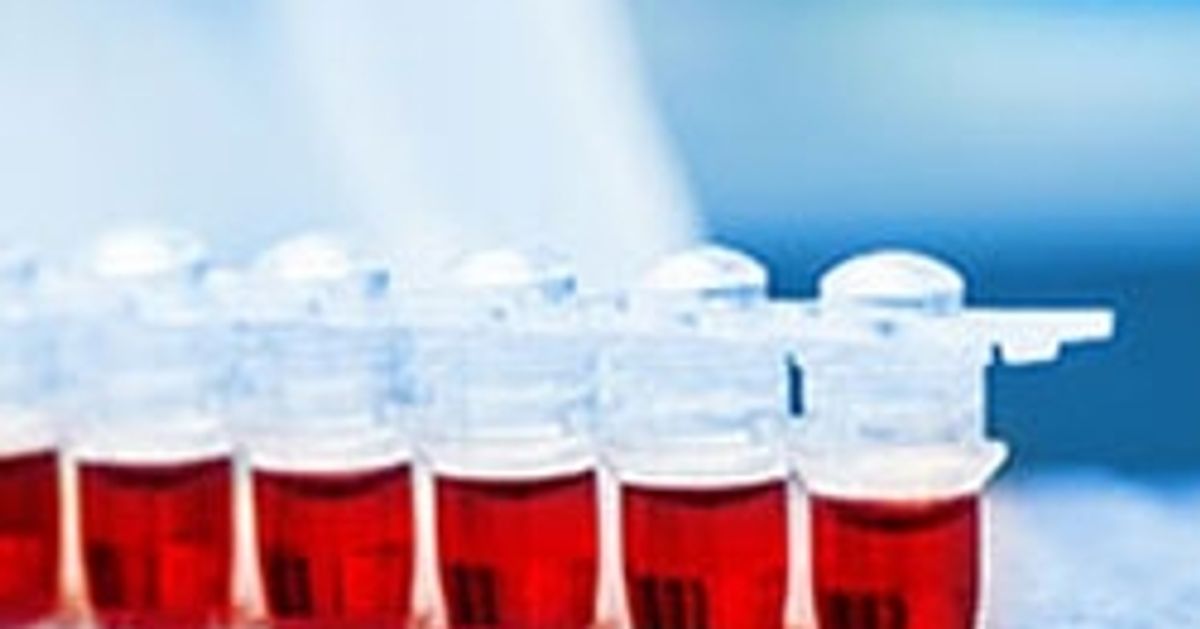 Novel Blood Screen Reveals Risk of Dying