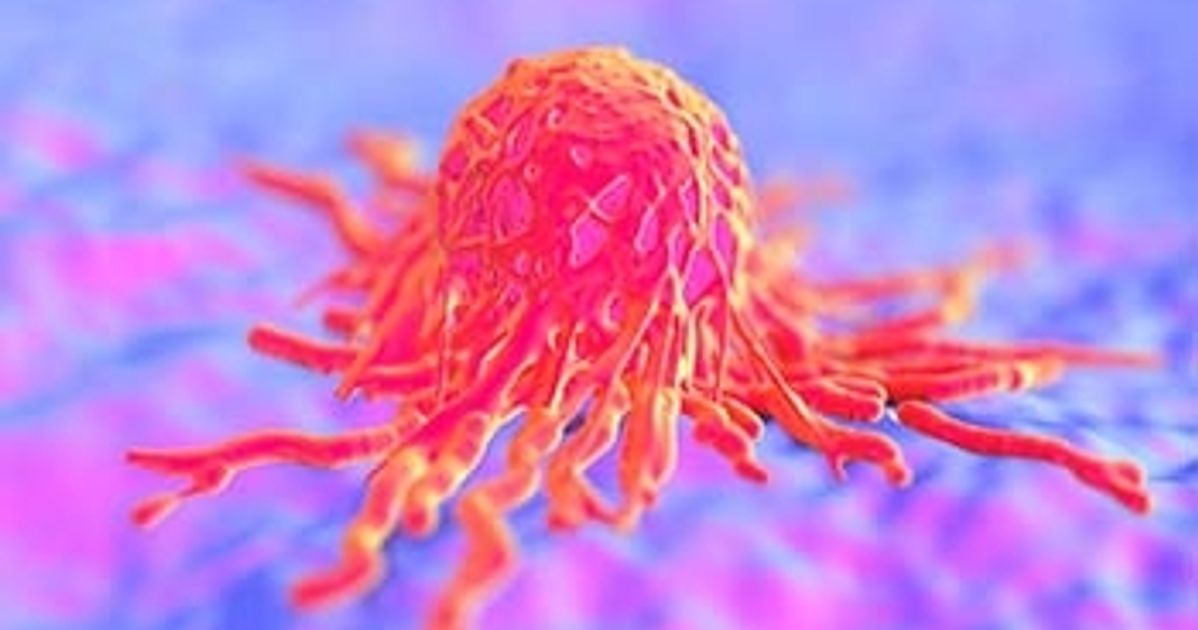 New Oncomine Childhood Cancer Research Assay Launched by Thermo Fisher ...