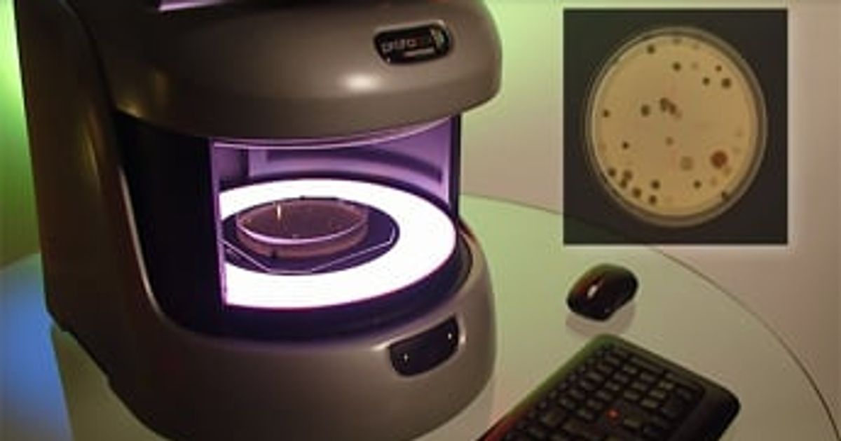 ProtoCOL 3: Automatic Colony Counting and Zone Measurement from Synbiosis