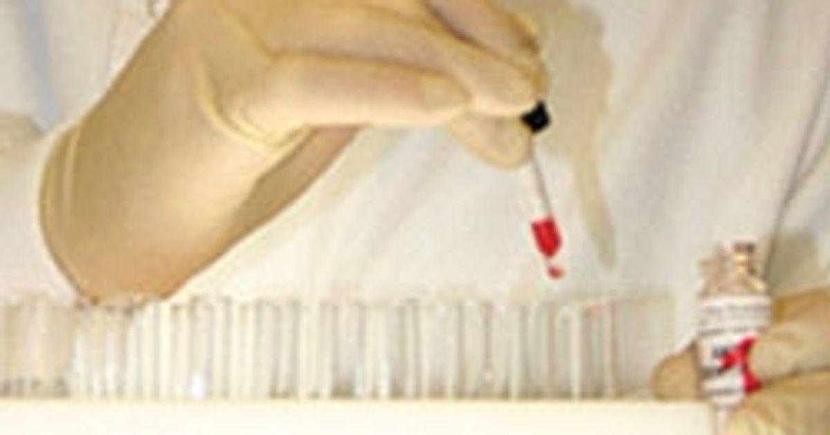 Albasure Sensitivity Controls for Routine Compatibility and Antibody ...