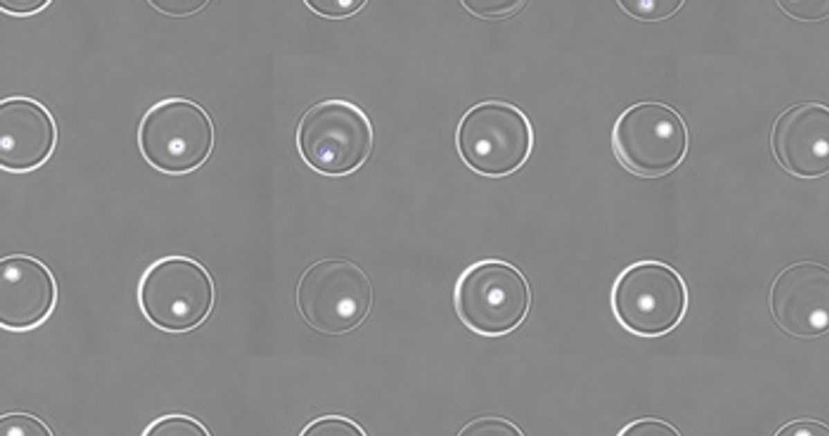 One-in-a-Million: How to Successfully Isolate a Single Cell