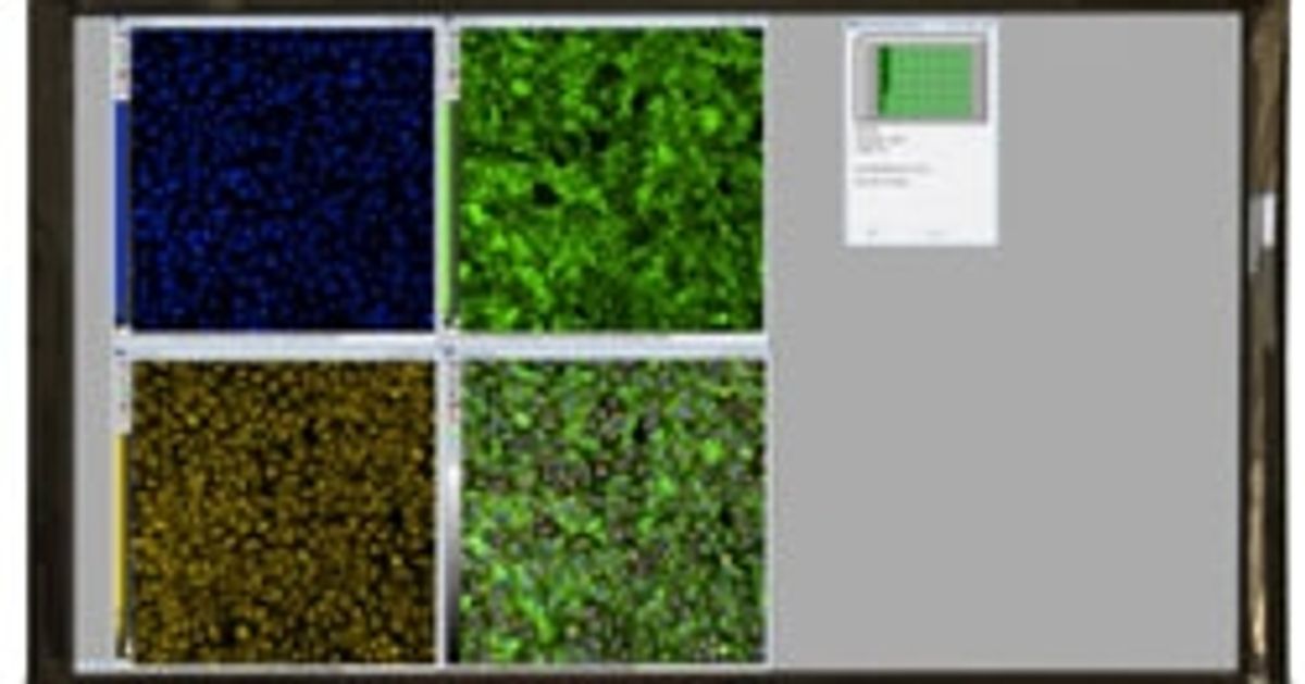 MetaXpress High-Content Image Acquisition and Analysis Software reviews