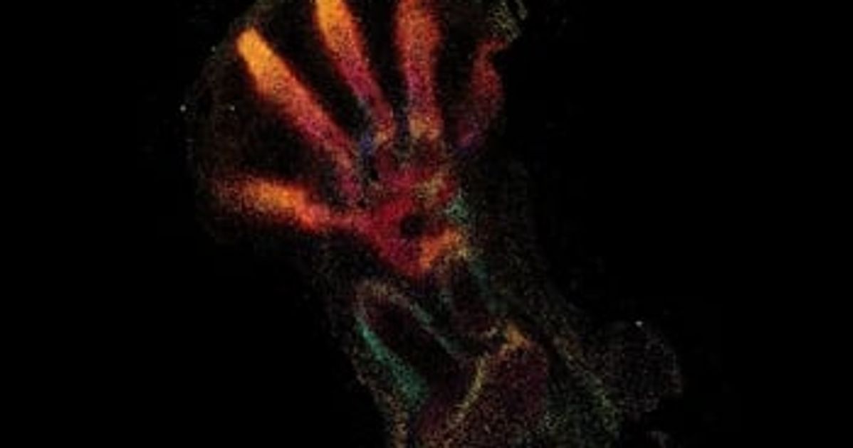 ‘Google Maps’ for the human body – How spatial genomics is ...