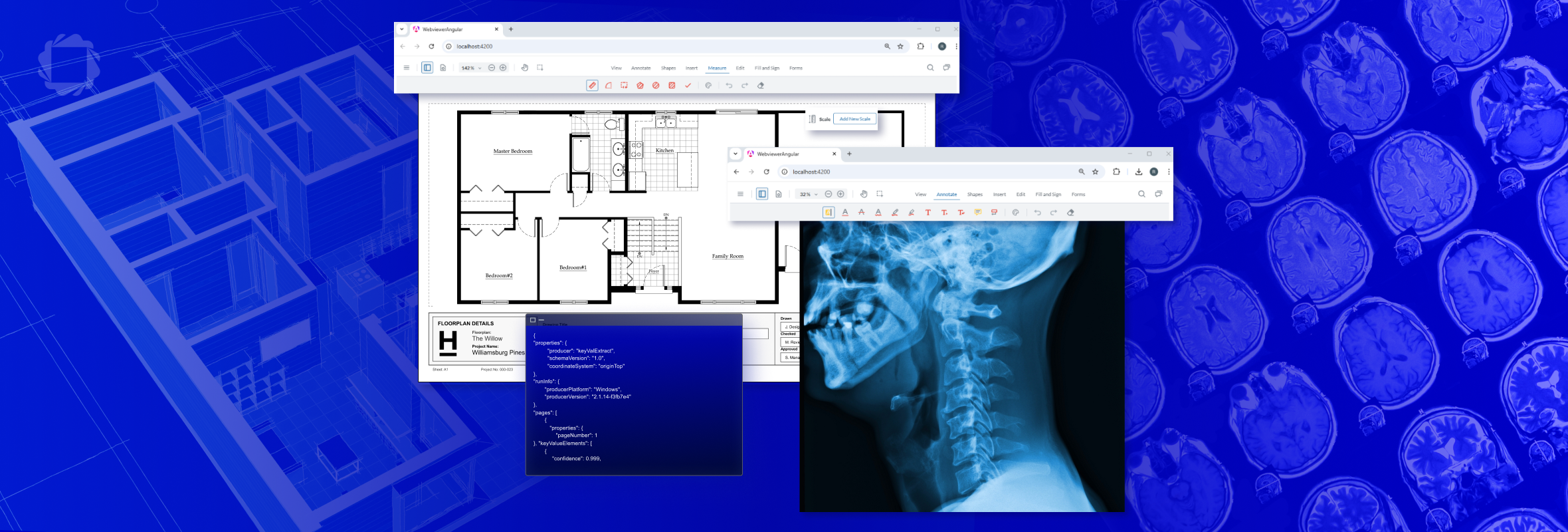 Build a Custom Angular PDF Viewer with PDF.js | Apryse