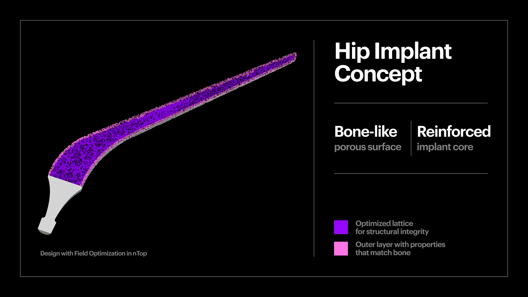 Improving the biomechanical profile of additive hip implants with Field Optimization | nTop