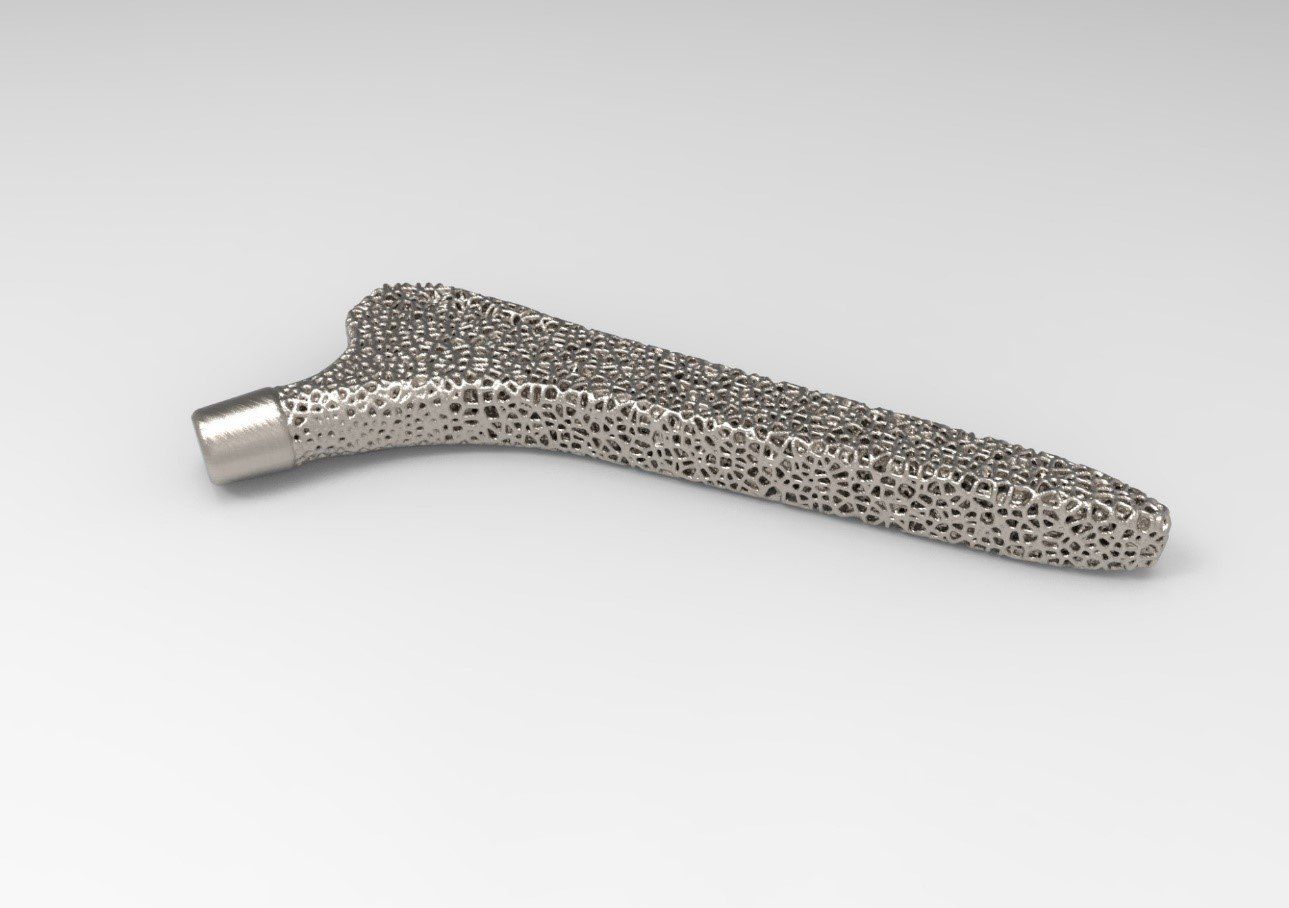 How to optimize a patient-specific hip implant stem | nTop | nTop