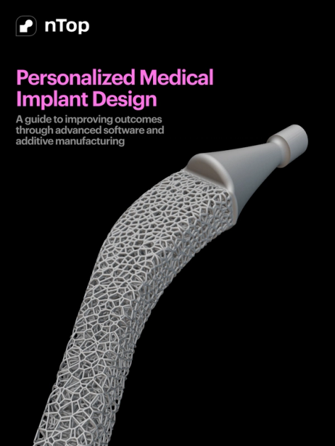 Download the Advanced Design Software Guide for Personalized Implants