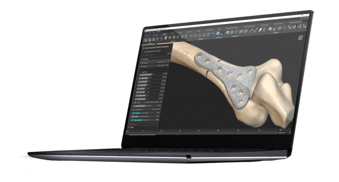 3D printing implants: A complete guide | nTop