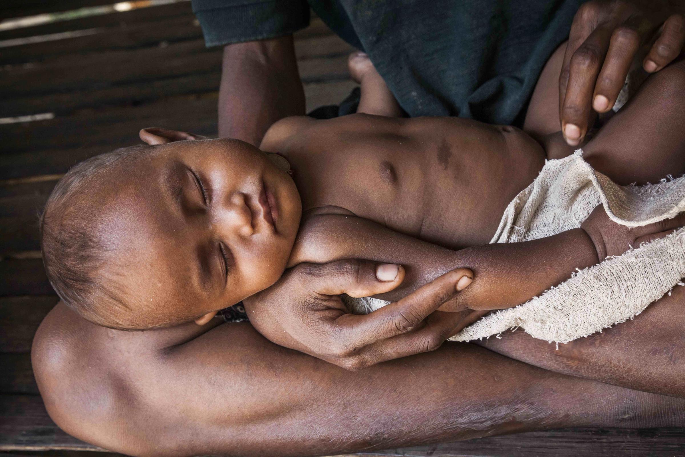 3 Common Childhood Fears & Phobias | ChildFund Australia