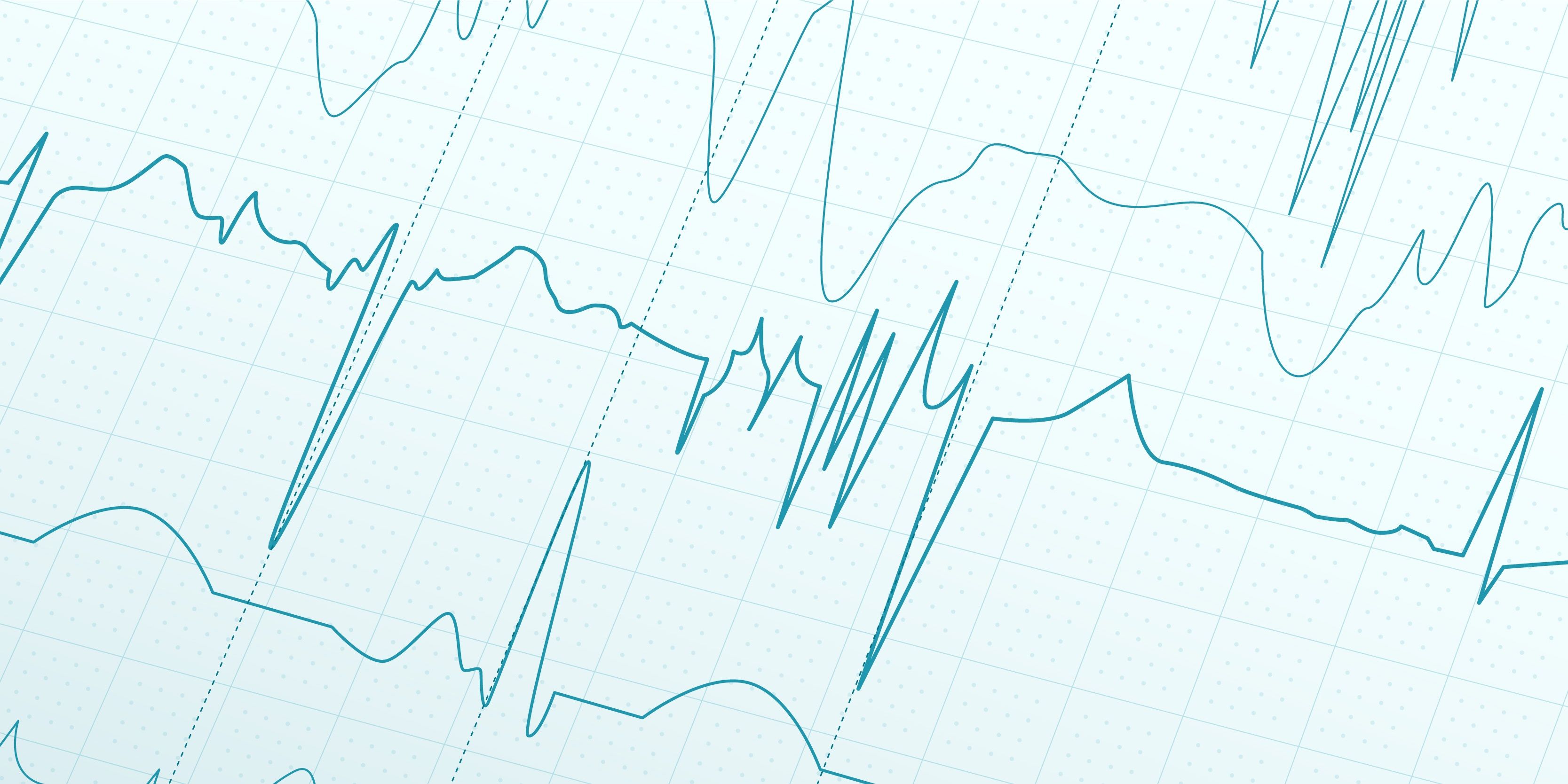 Is pulse rate the same as heart rate? | Blog | Empatica