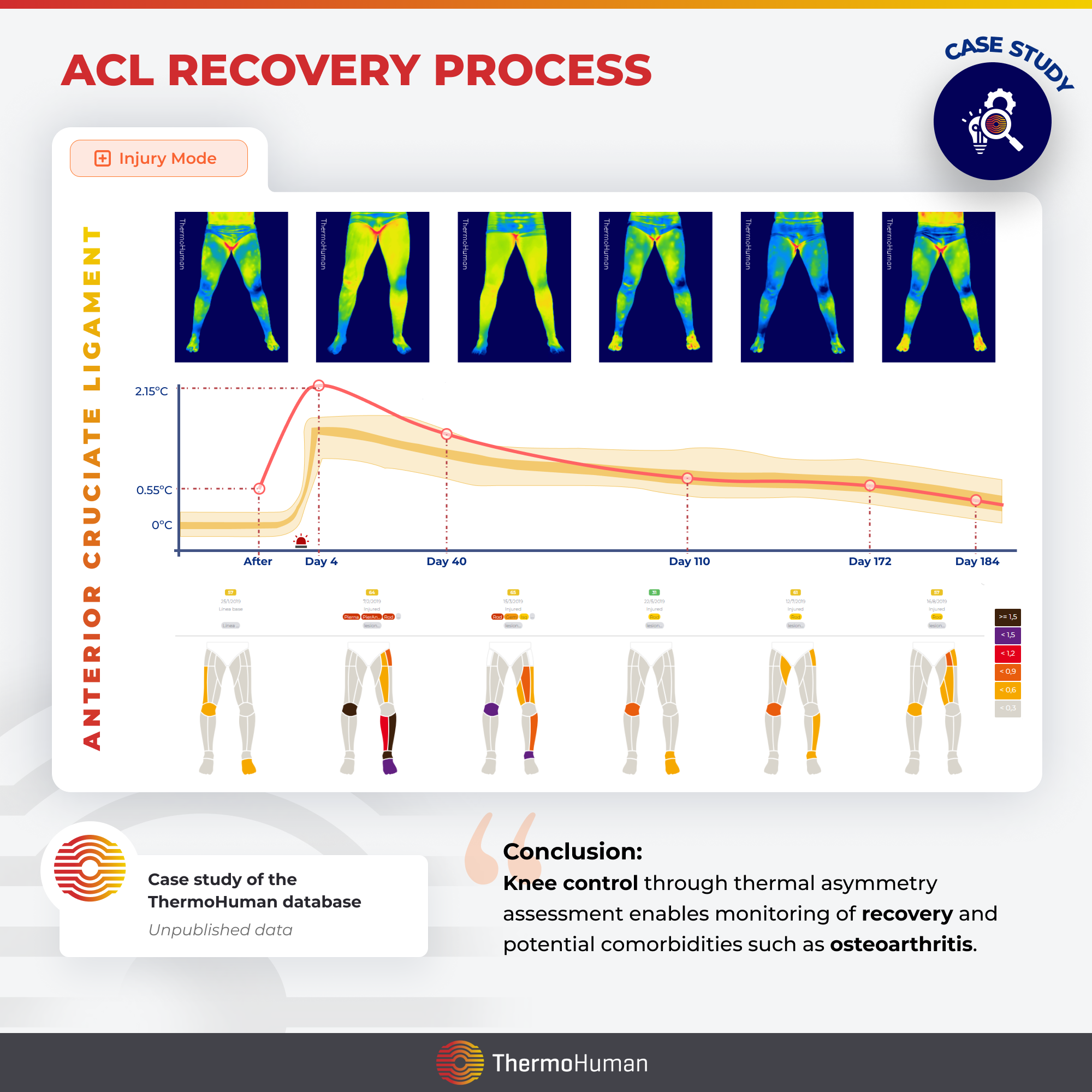 The evolution graph of an anterior cruciate ligament (ACL) injury ...