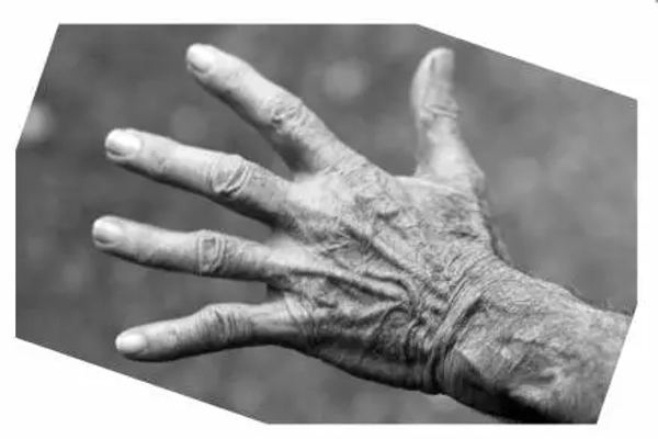 What is restless arm syndrome? | Phoenix Rehab Singapore