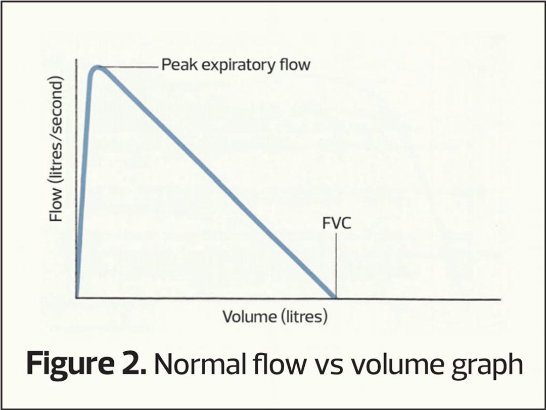 Spirometry: interpretation in the clinical situation
