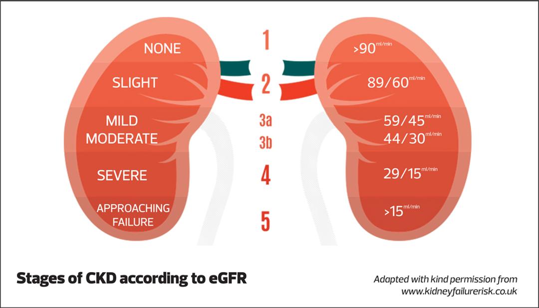 Practice Nurse bite-sized learning: Understanding chronic kidney disease