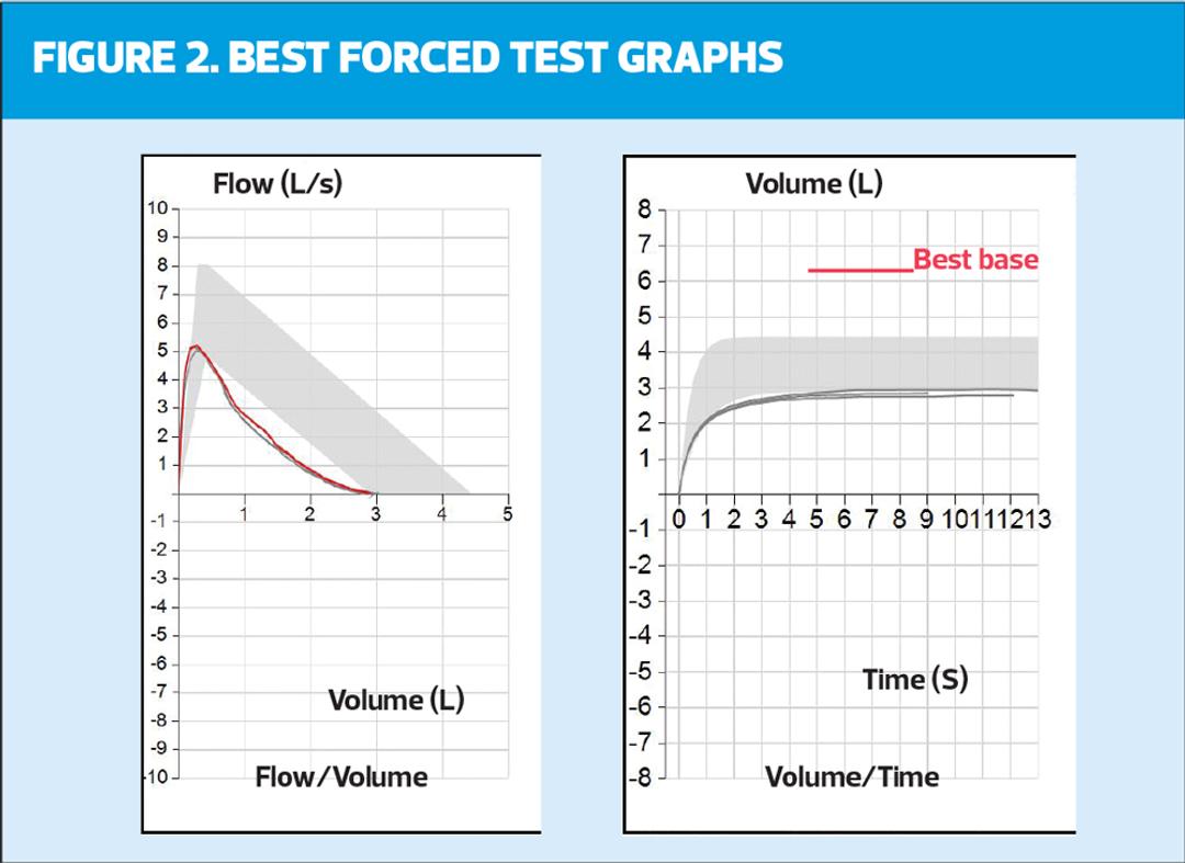 Spirometry – moving forward towards early and accurate diagnosis