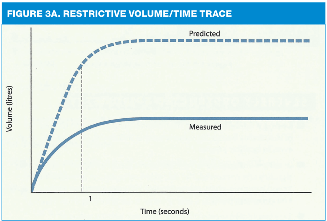 Spirometry: Understanding the results