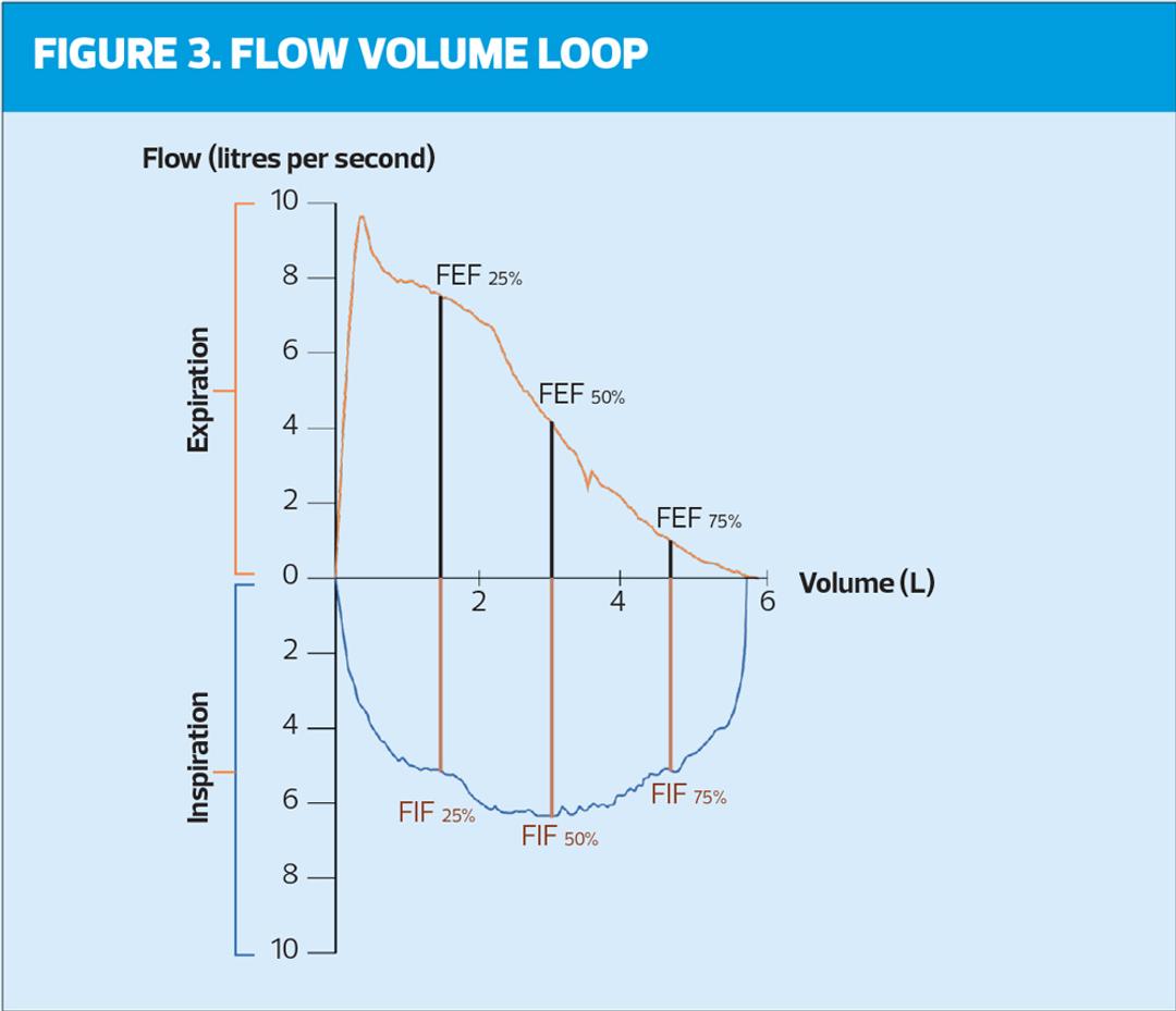 Spirometry – moving forward towards early and accurate diagnosis
