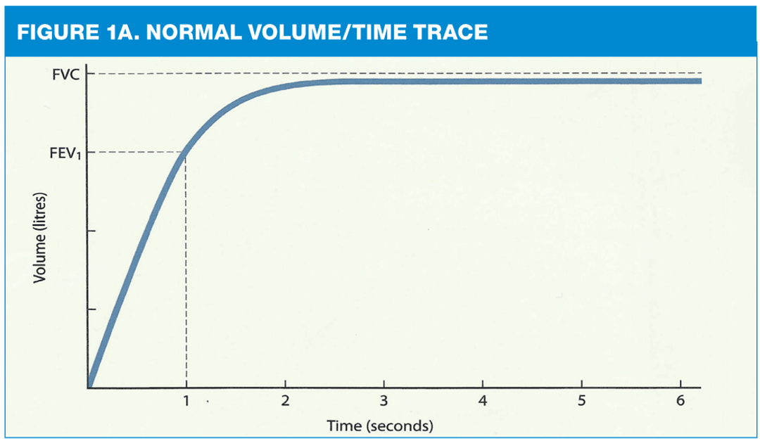 Spirometry: Understanding the results
