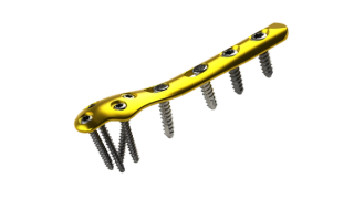 Plates and Screws