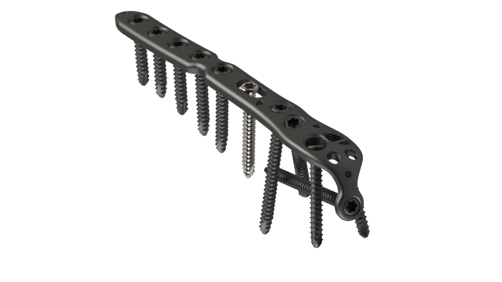 Plates and Screws