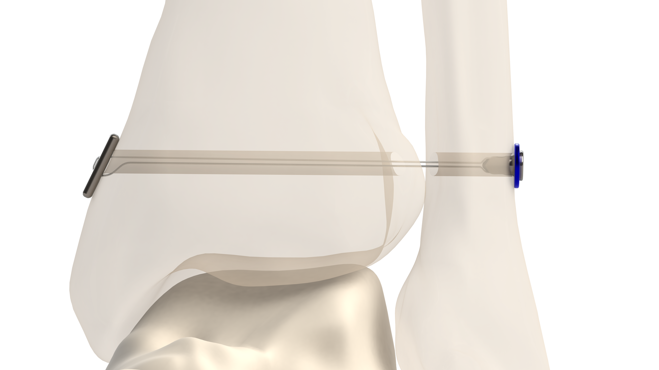 Ankle