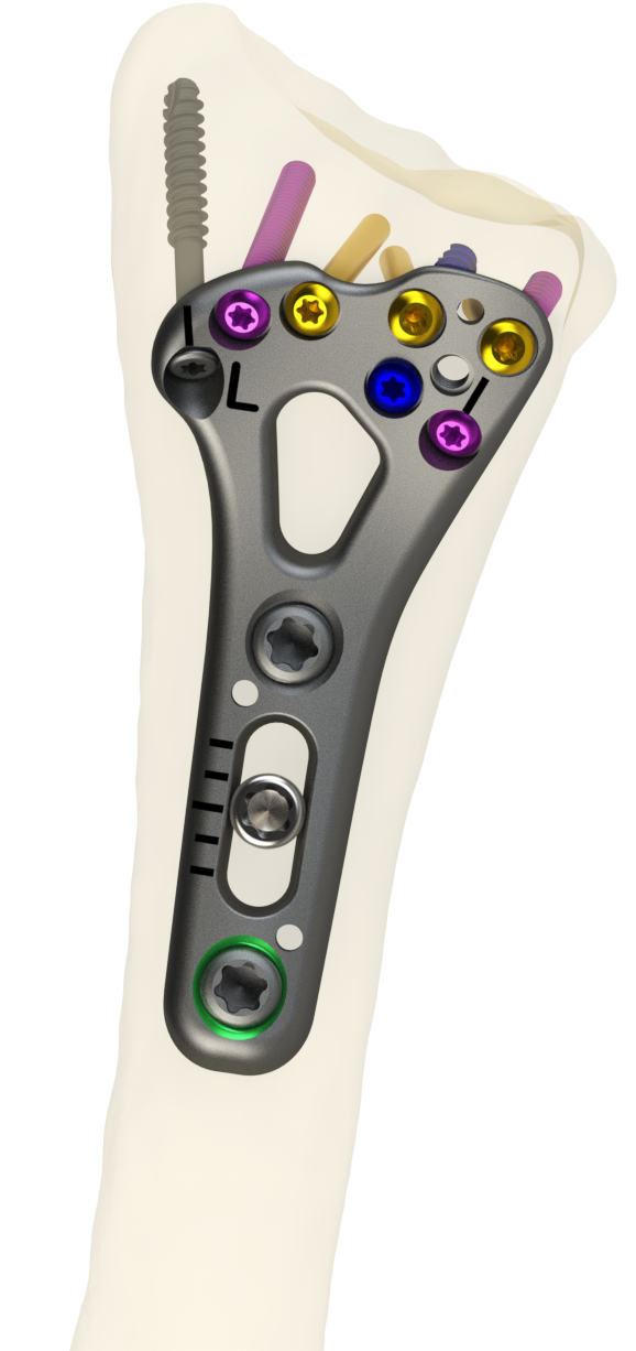 Orthopaedic Implant Company | Value Based, Clinically Proven Implants