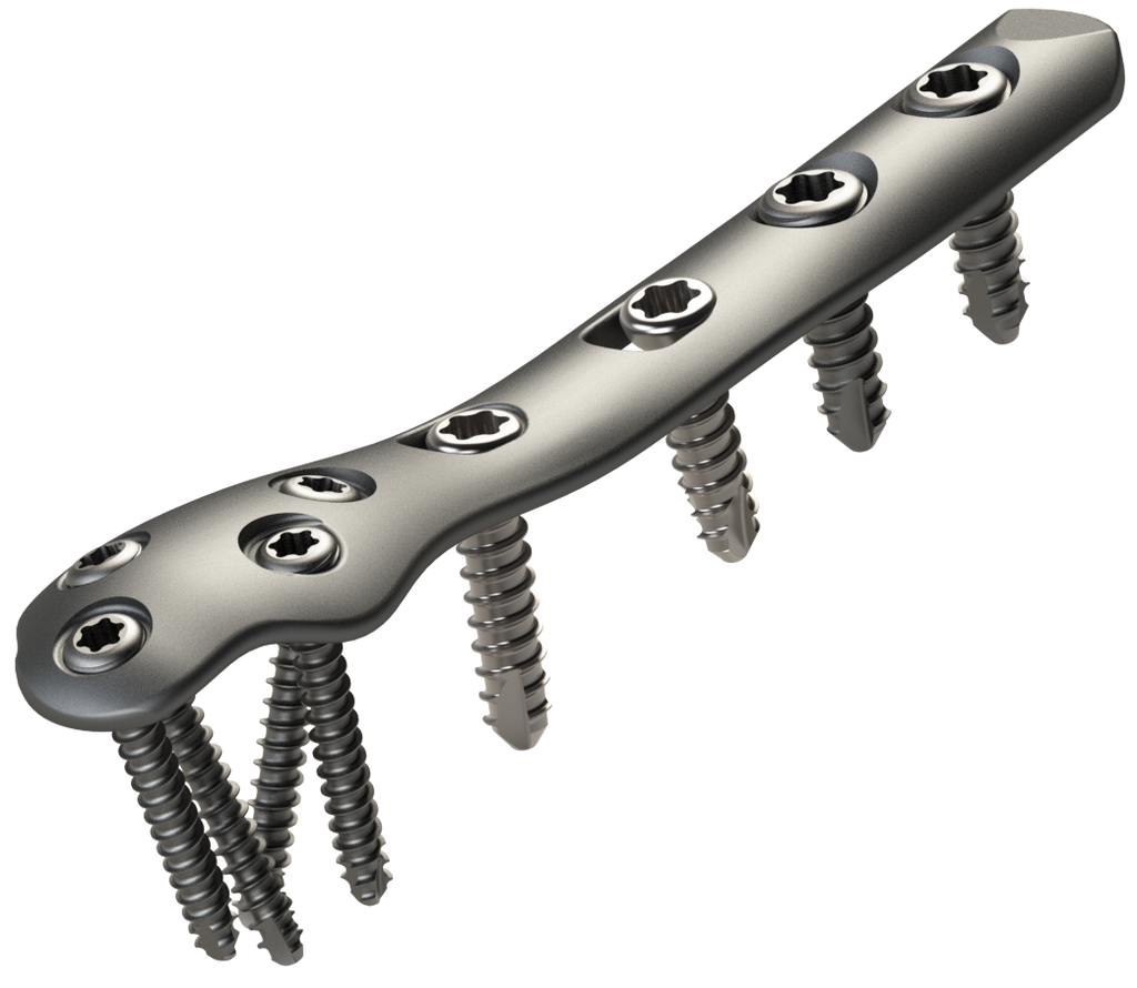 Plates and Screws