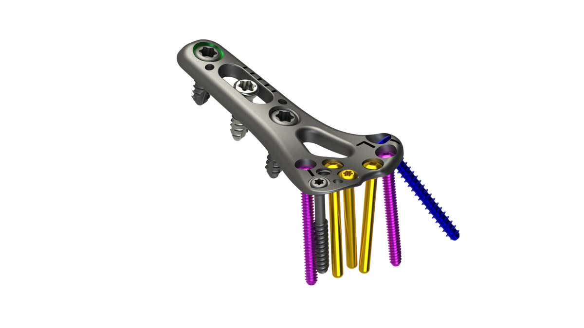 Plates and Screws