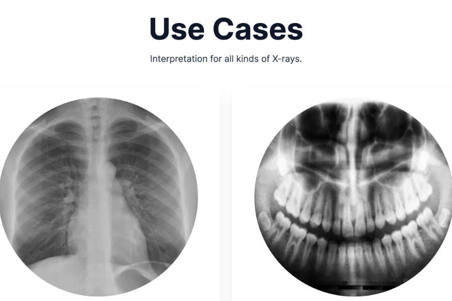 X-ray Interpreter - Features, Pricing, Reviews & More 2024