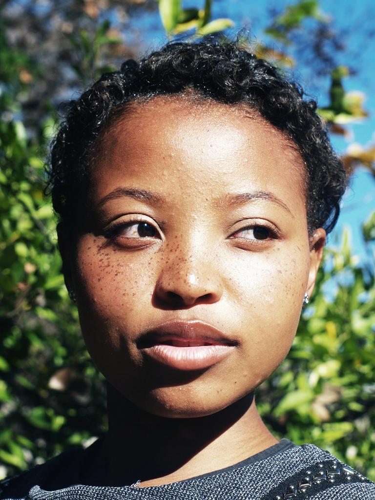 Hyperpigmentation: Treating pigmentation issues in black skin | Glowday