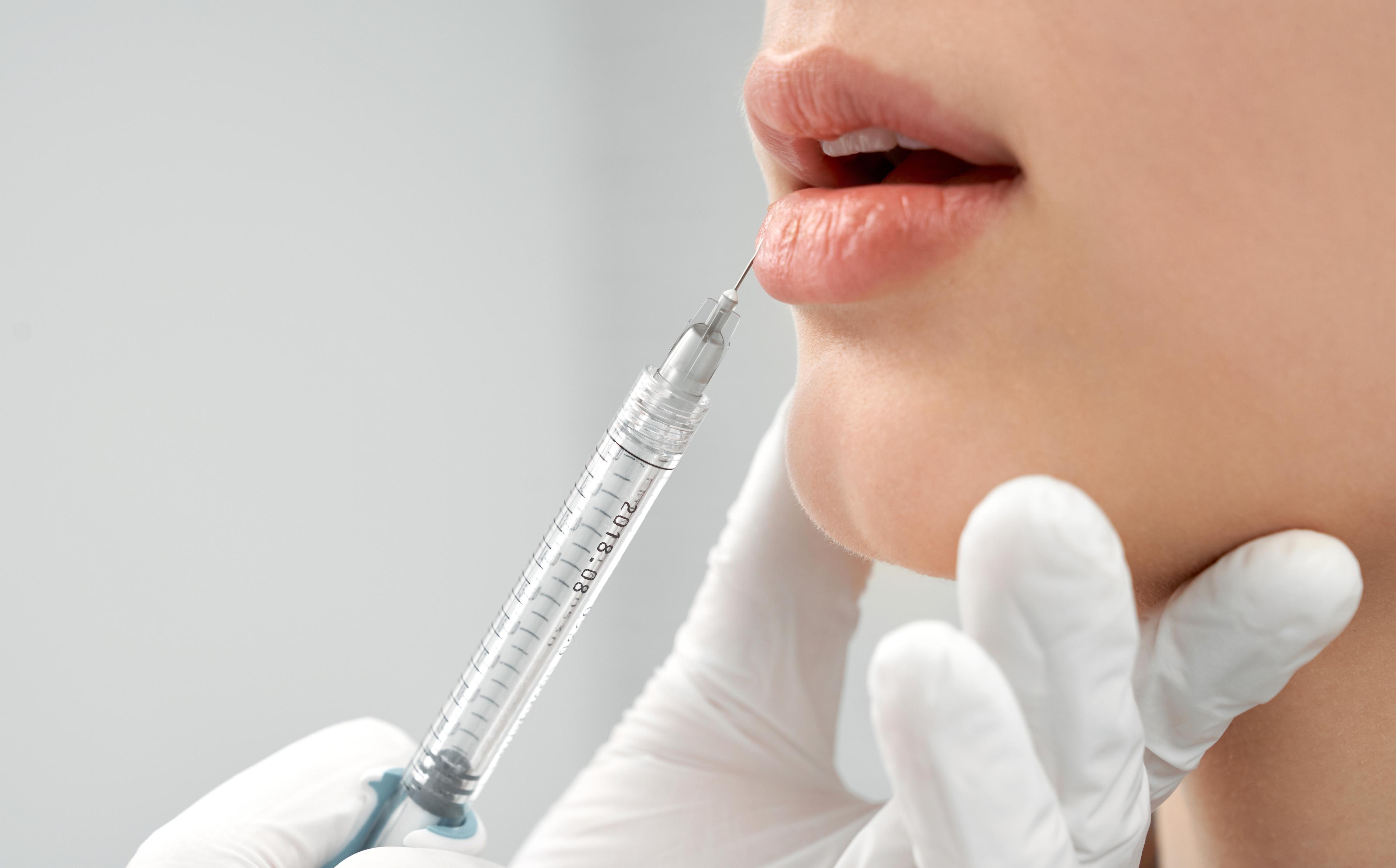 Dissolving Fillers Heres What You Need To Know Glowday