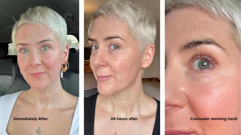 Polynucleotide treatments - Ten dos and don't before and after ...