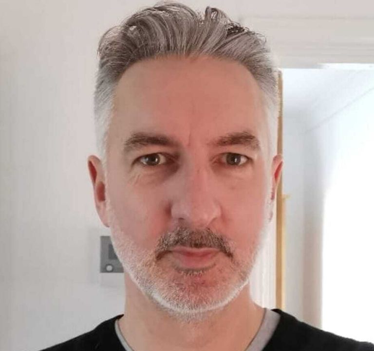 Botox for men, why I think it's great! | Glowday