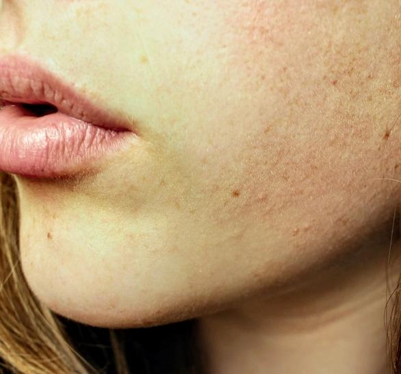 Lip fillers - plumping and reshaping lips | Glowday