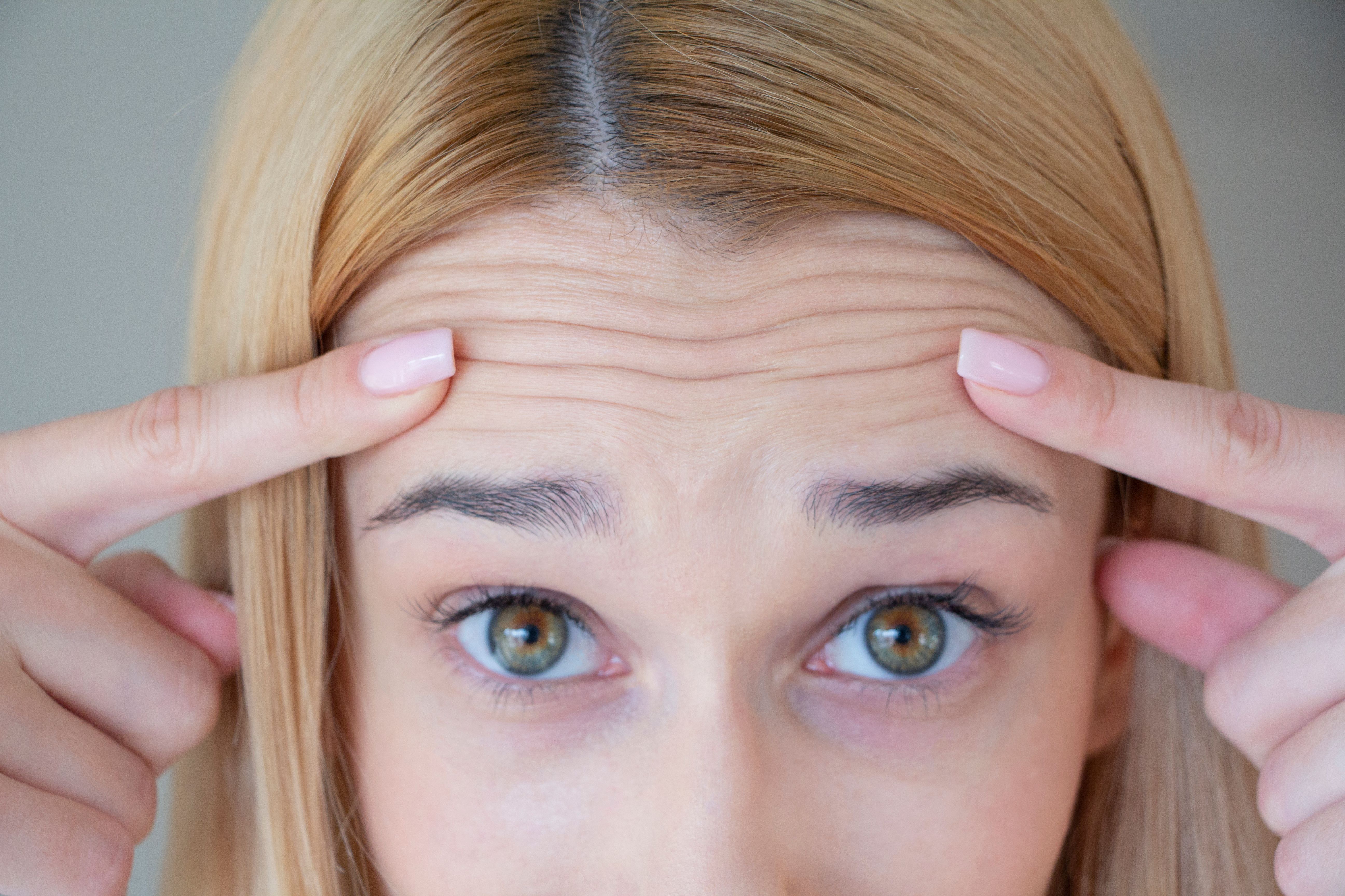 Move over Botox - It’s All About Fillers In Your Forehead! | Glowday