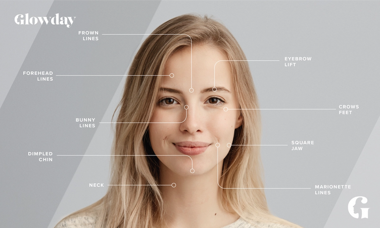 Does Botox Make You Look Frozen? | Glowday