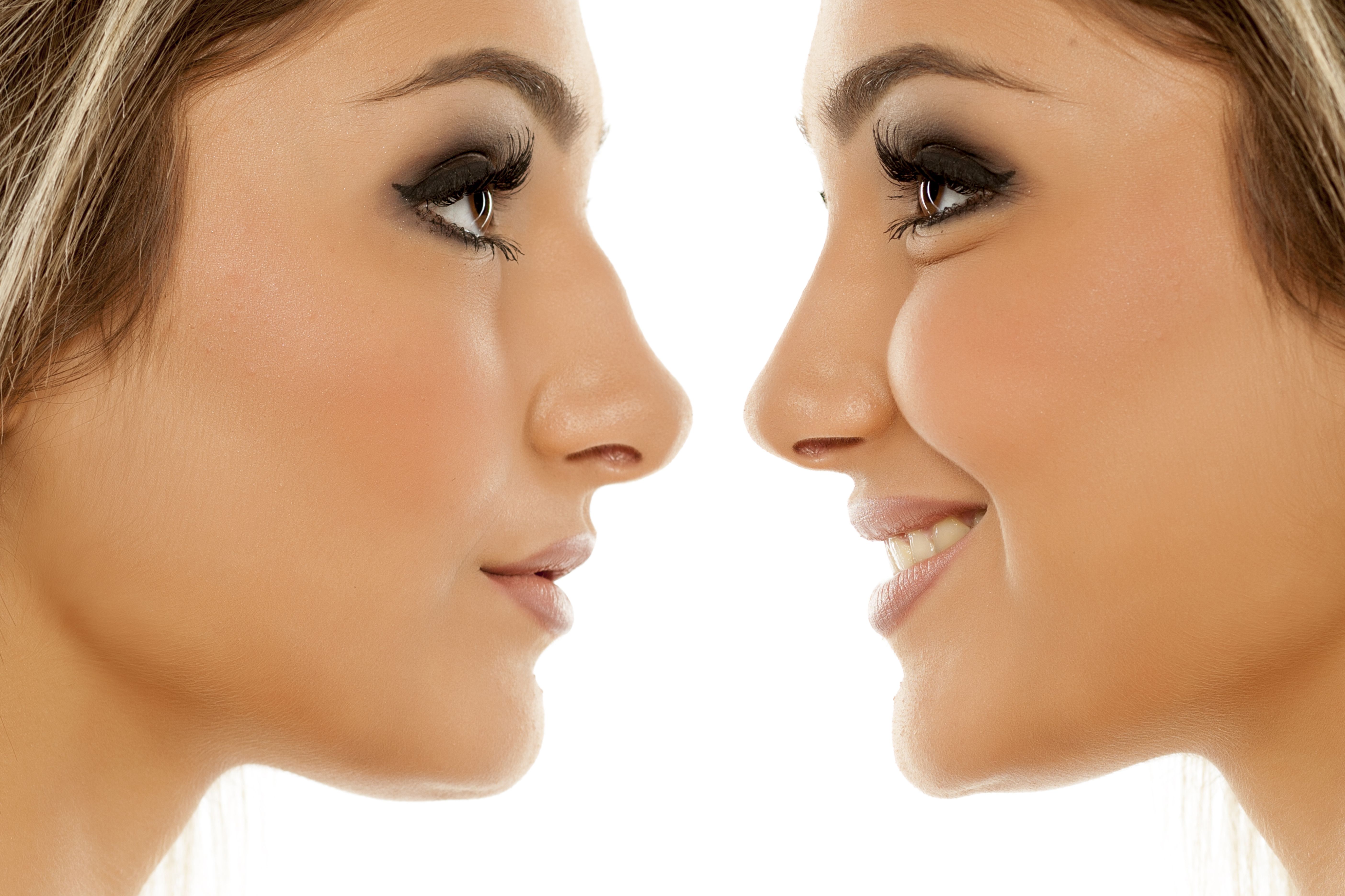 Everything You Need To Know About The Non Surgical Nose Job | Glowday
