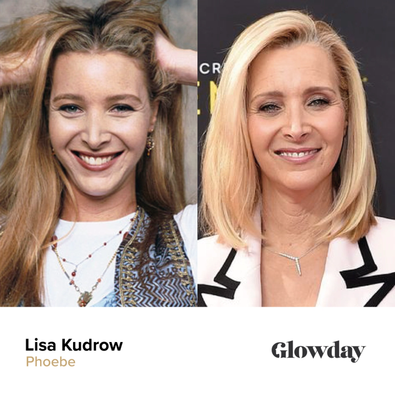 Friends Cast Then and Now: Botox or Filler? | Glowday