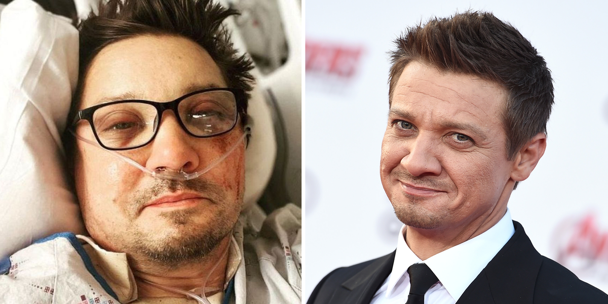 Jeremy Renners kamp tilbake etter ulykken: – Jeg har prøvd alt - Filmweb