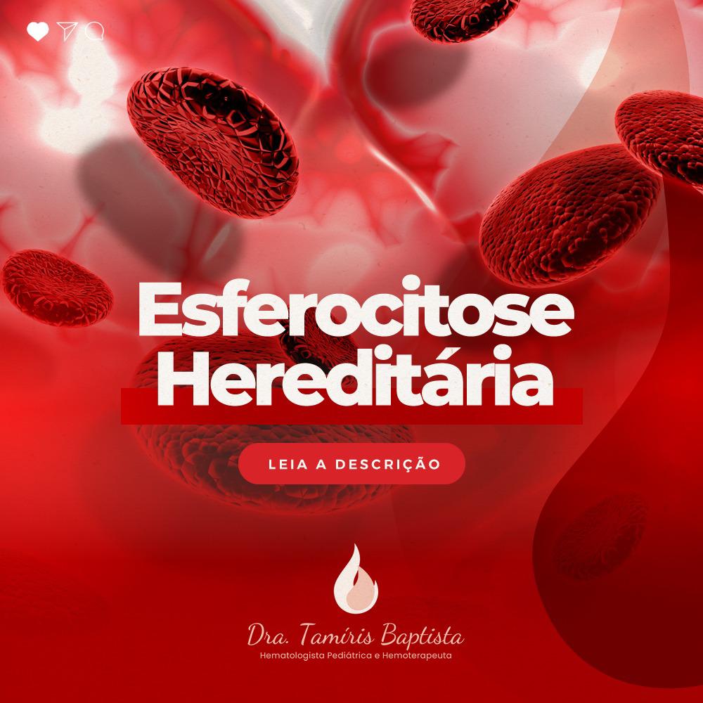 O que é Esferocitose Hereditária? | Dra Tamíris Baptista