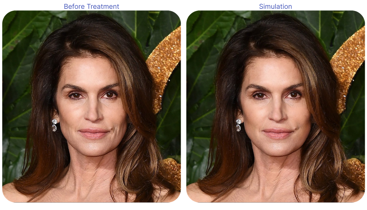 Sculptra: AI Aesthetic Simulator - EntityMed