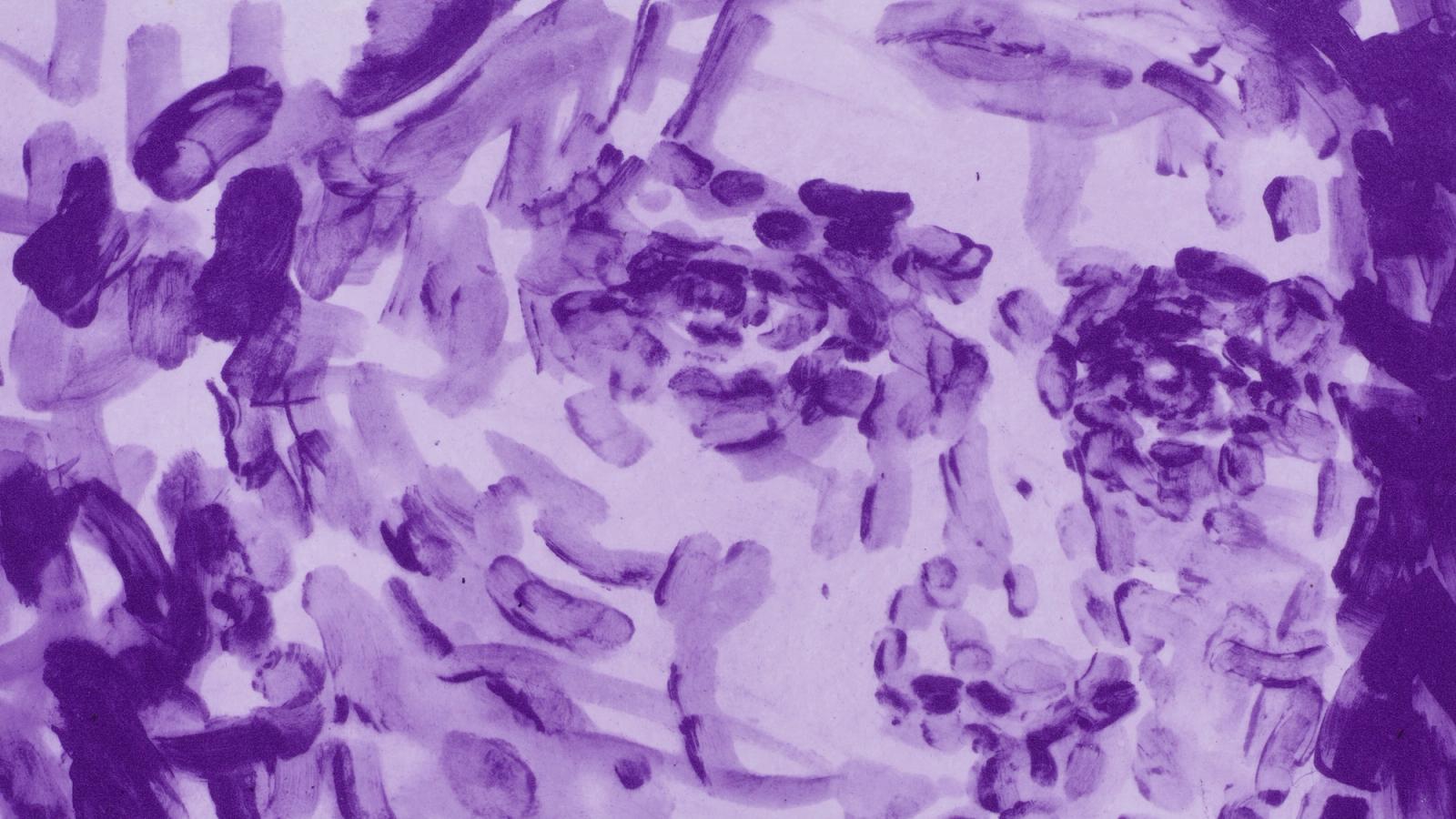 Elizabeth Peyton: Prints Since 2000 | June 3—July 31, 2025 | David Zwirner