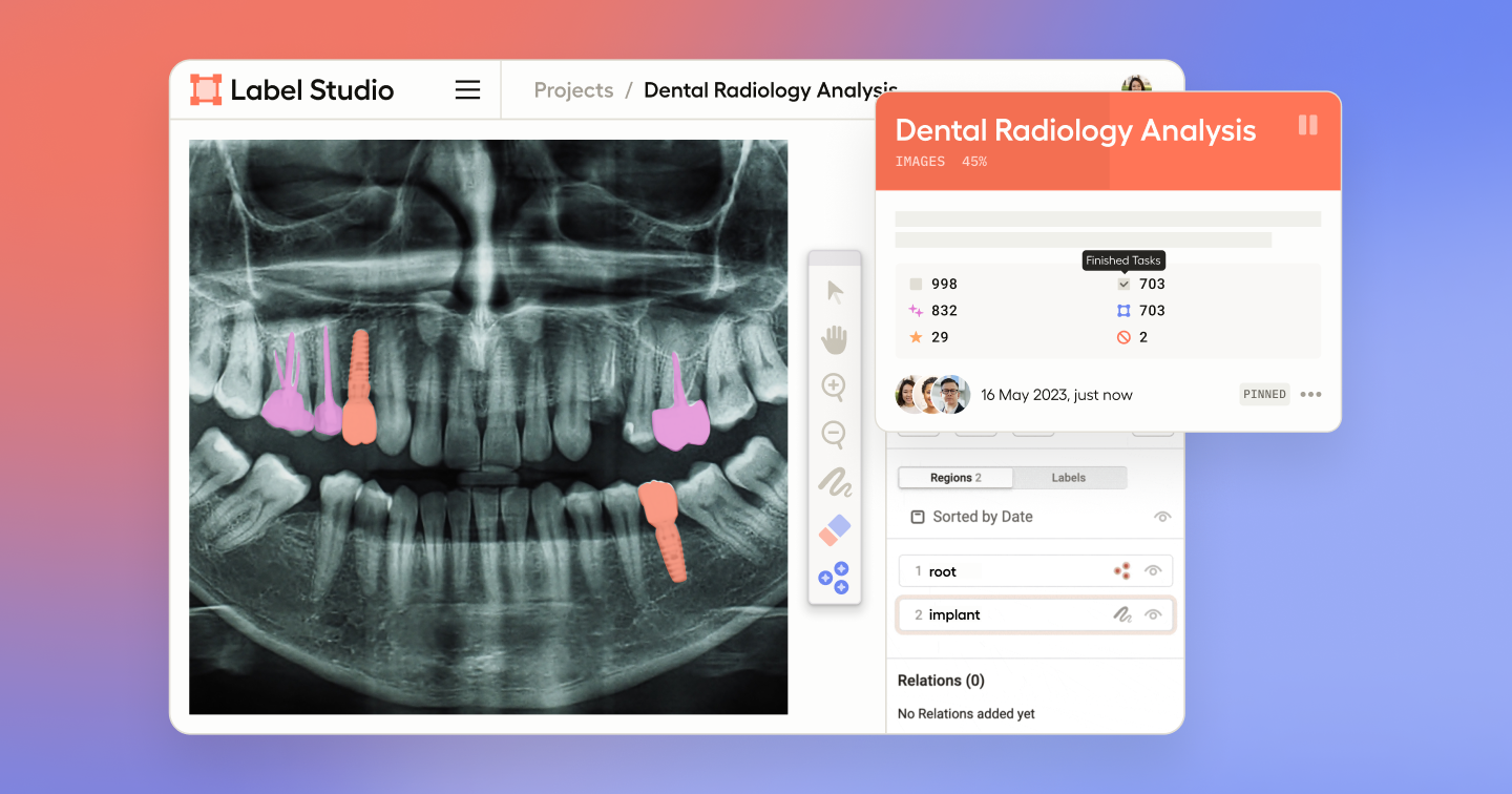 Medical Data Labeling and Label Studio | HumanSignal