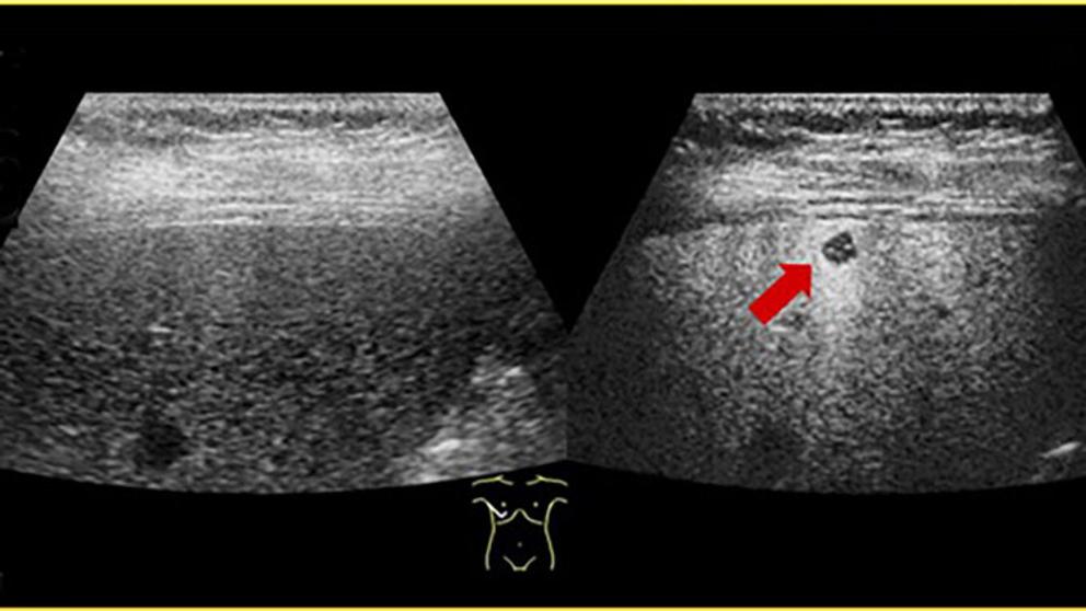 Sir William Castell: championing Norway’s pioneers of ultrasound ...