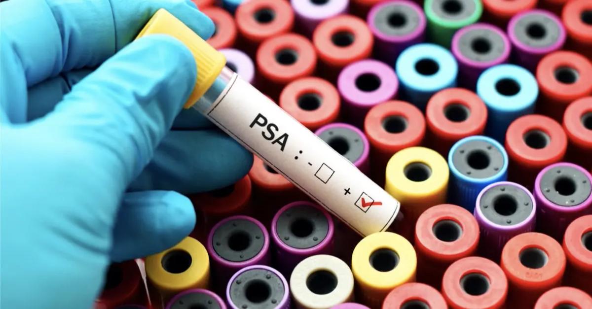 PSA-verdier: Kjenner du PSA-skalaen?