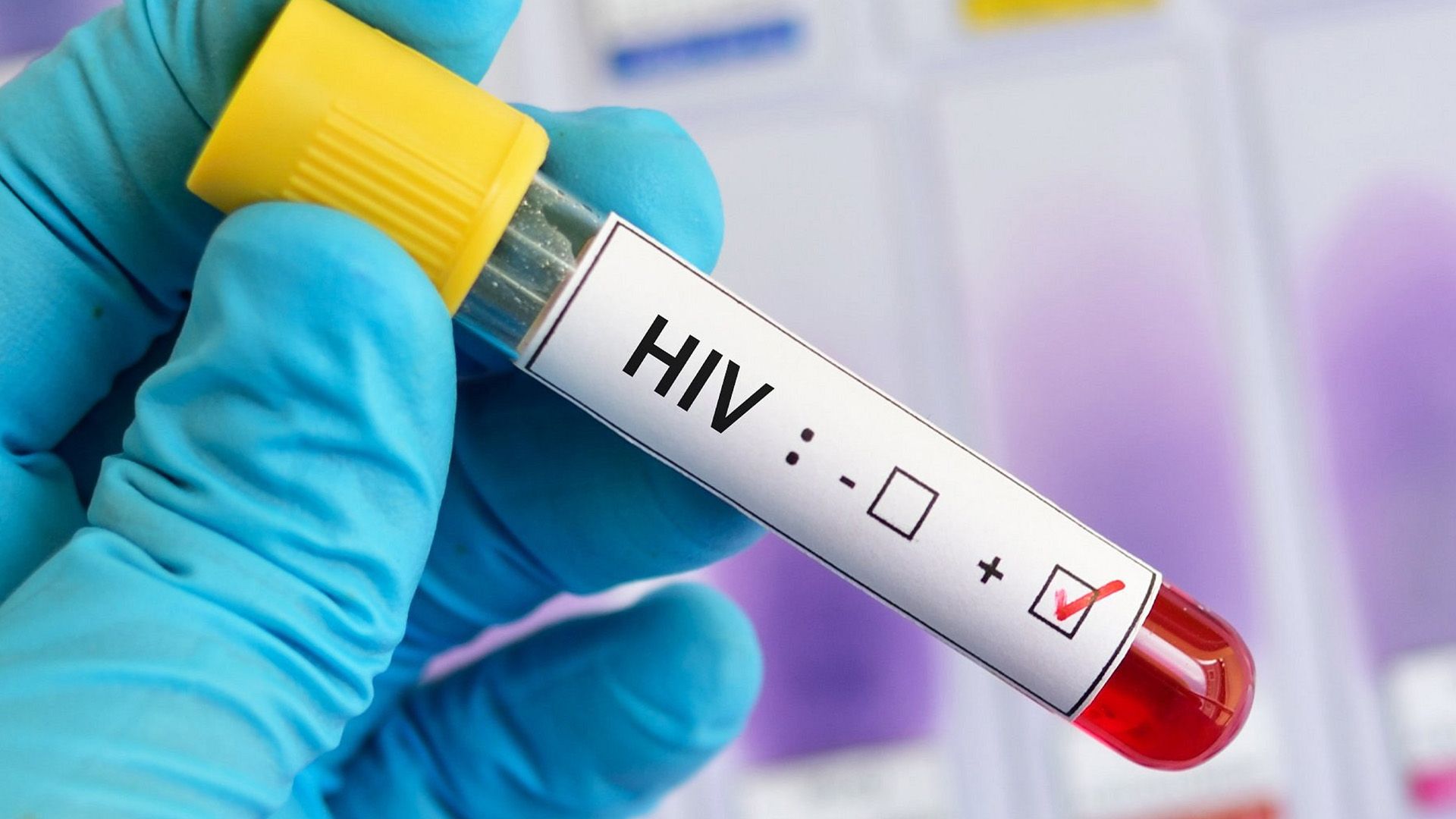 HIV Cases in Malta Doubled Over 30 Years, Dr Says