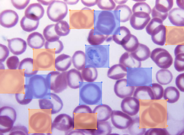 Data Labeling Platform for Machine Learning | HumanSignal