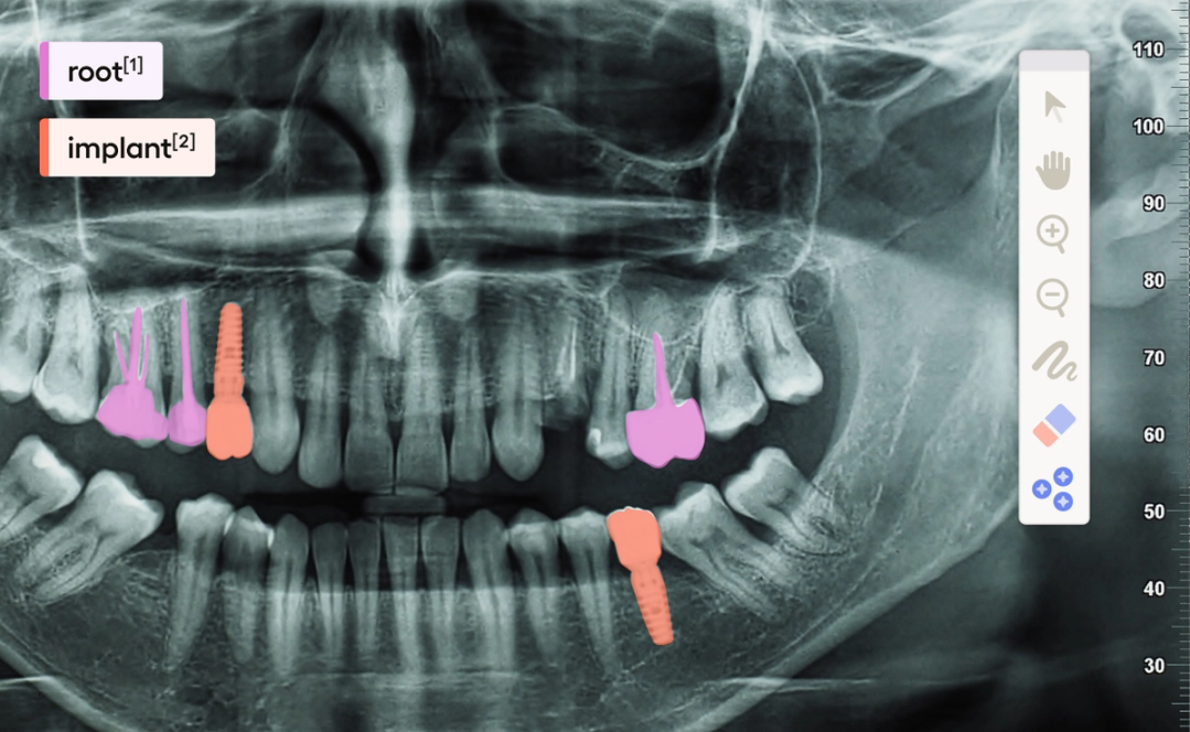 Data Labeling Platform for Machine Learning | HumanSignal