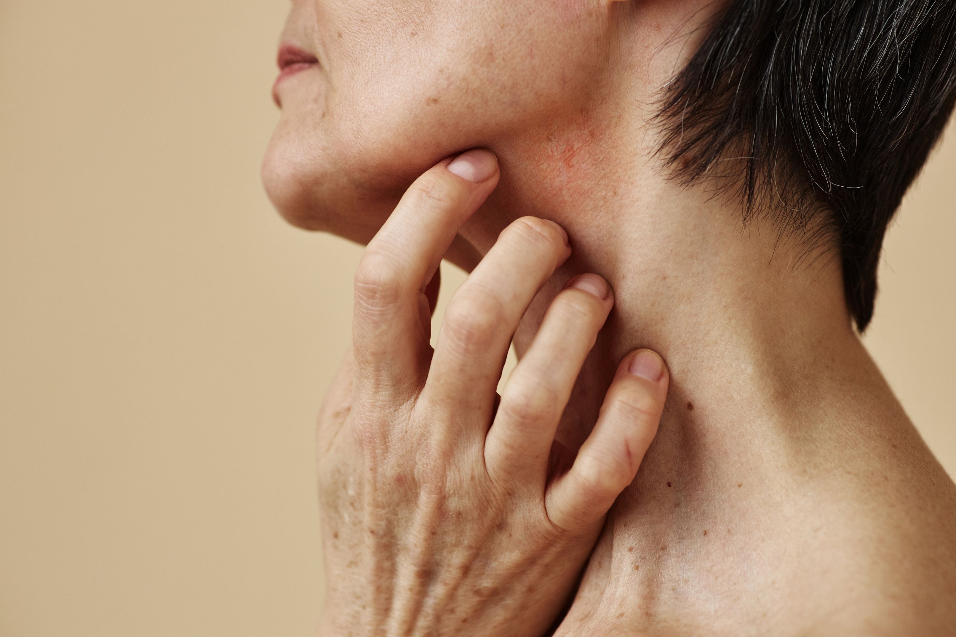 Eksem: alt du bør vide - symptomer, behandling og årsager